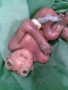 humanfrog baby